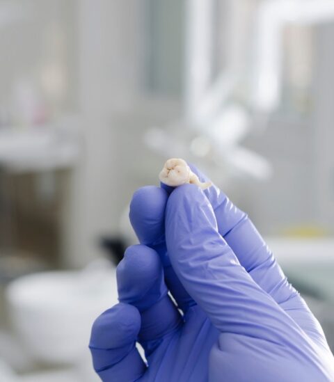 Teeth Extractions - Ambrosi Place Dental Care